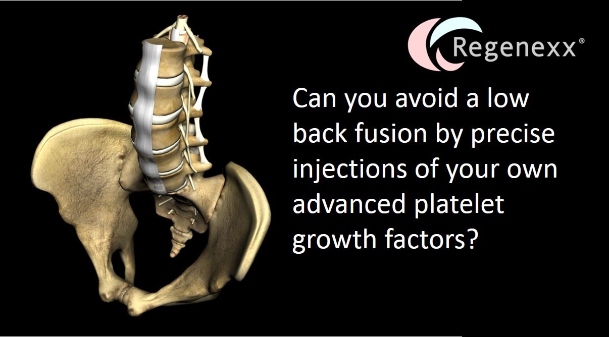 Back Fusion Alternatives - Wasatch Pain Solutions